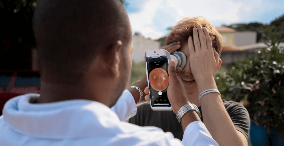 Connected to a smartphone, Eyer handheld fundus camera offers high ...