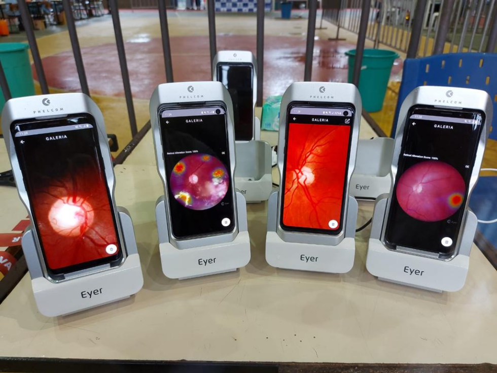 Eyer: mais de 500 mil pessoas tem acesso à exames de retina com aparelho portátil - PHELCOM ...