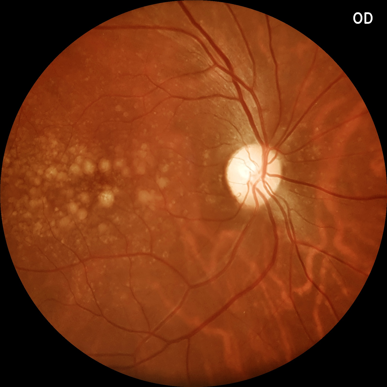 DMRI - PHELCOM Technologies