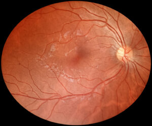 Eyer2 - PHELCOM Technologies